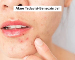 Benzoxin Jel Ne İşe Yarar? - Cilt Hastalıkları ve Kozmetik